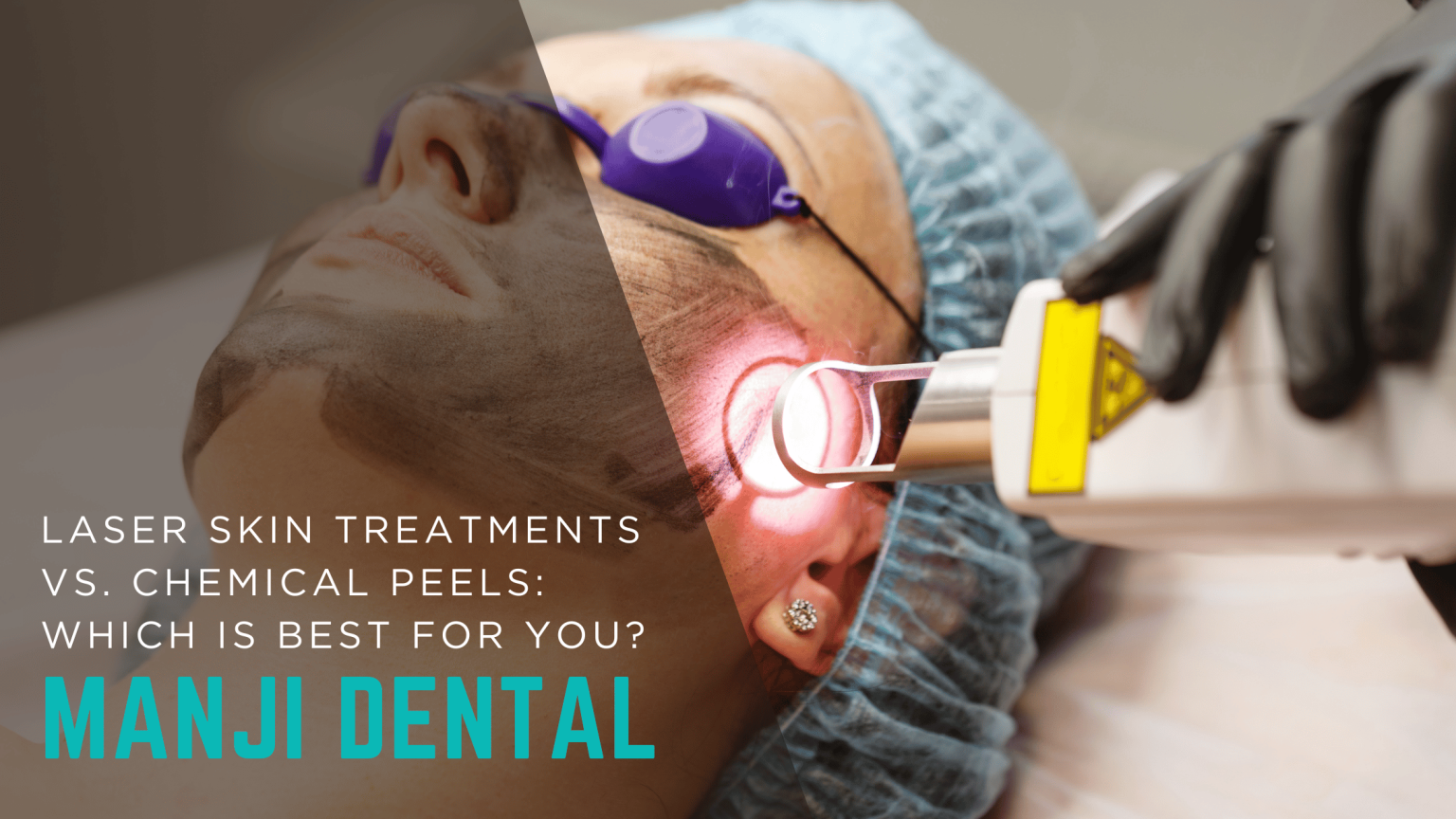 Laser Skin Treatments vs. Chemical Peels: Which is Best for You ...